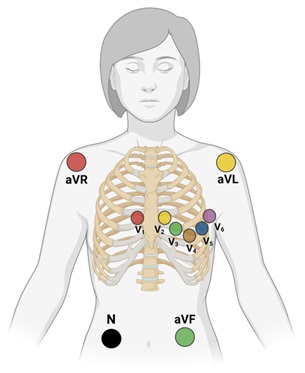 Taller de interpretación del electrocardiograma. | FISIOLOGÍA